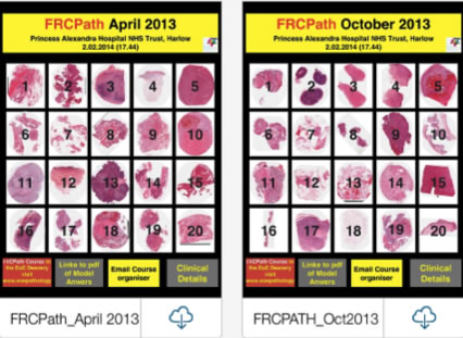 FRCPath Part 2 Histopathology Revision Course and Slideworkshop Courses ...